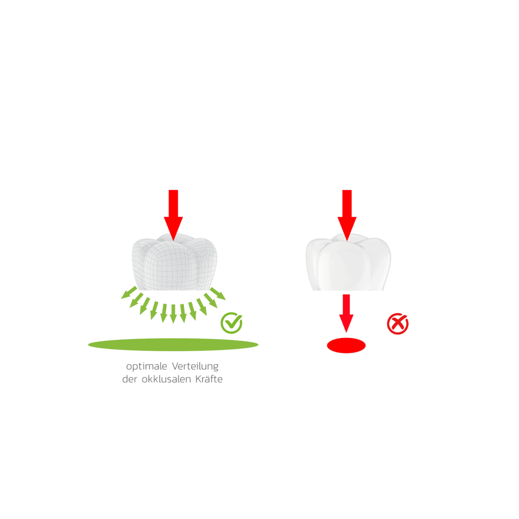 Trilor Arch - HPdent