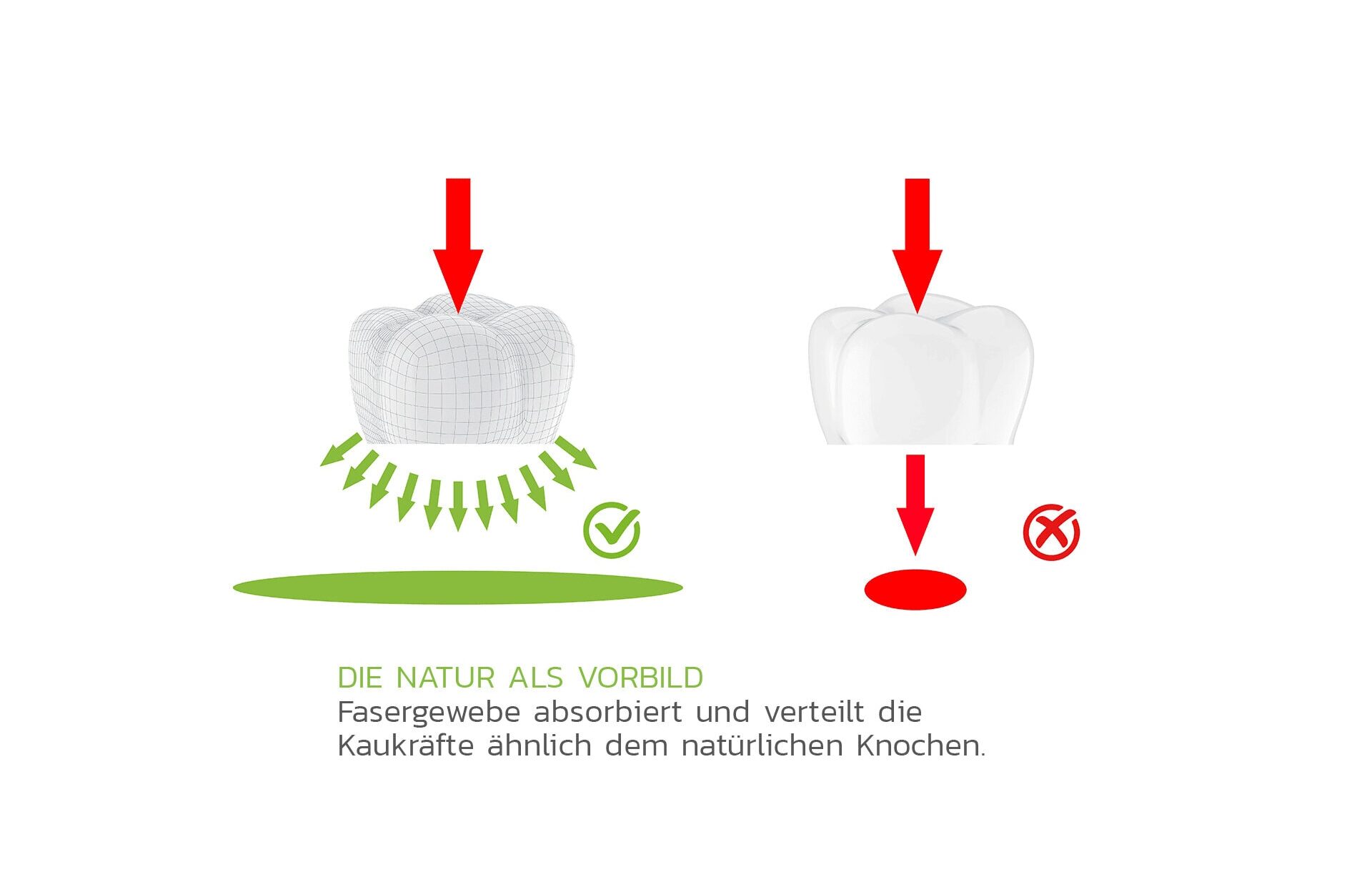 TriLor® Arch - HPdent