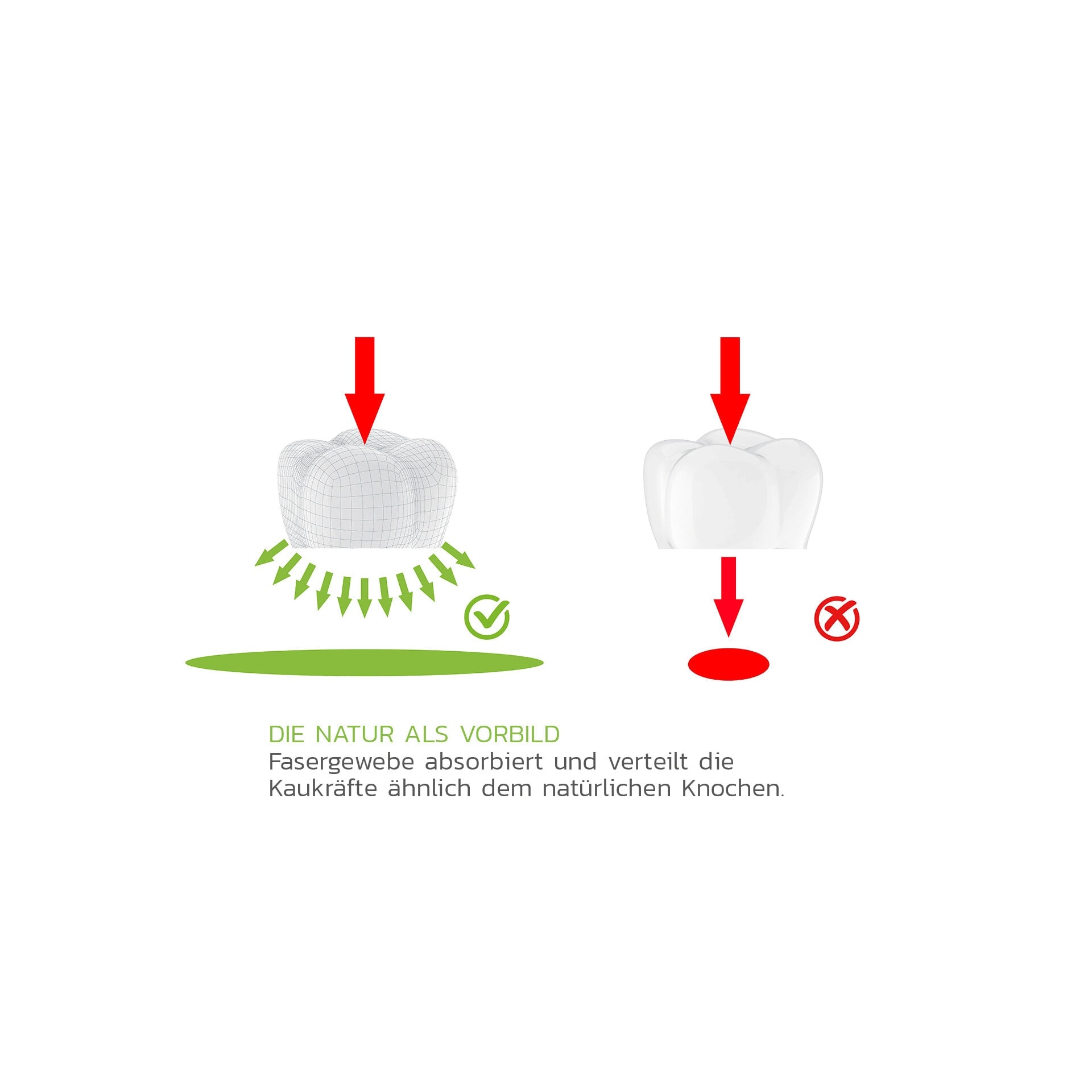 TriLor® Arch - HPdent